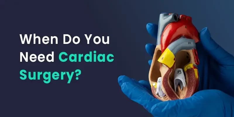 When Do You Need Cardiac Surgery? | Karetrip.com